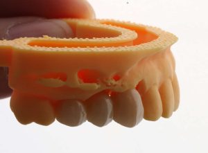 Dental Bridge: What Is It & What Do They Do | mydentist®